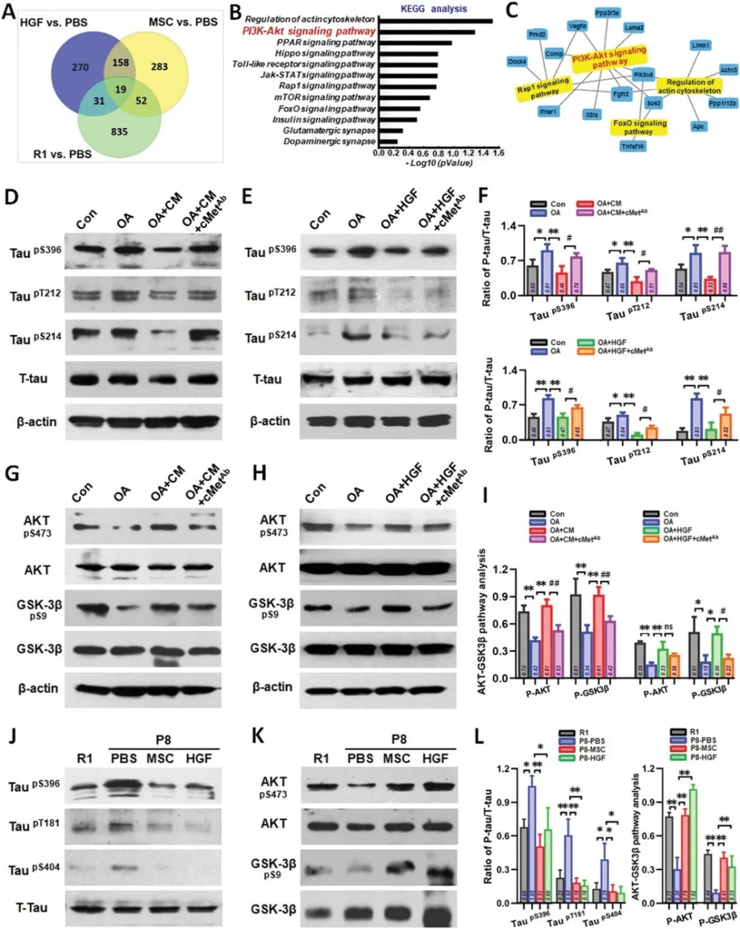 Adv Sci：干细胞治疗阿尔兹海默症的分子机理_hUC-MSCs