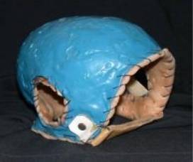 探秘：星星矫形头盔的发展简史_头颅_治疗_美国