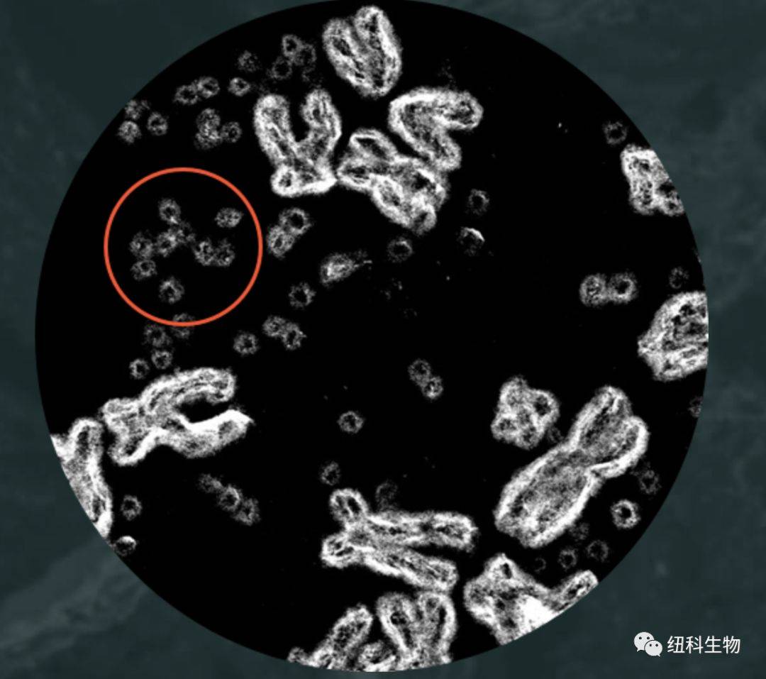 染色体外环状DNA：肿瘤研究新方向_ecDNA_癌症_基因