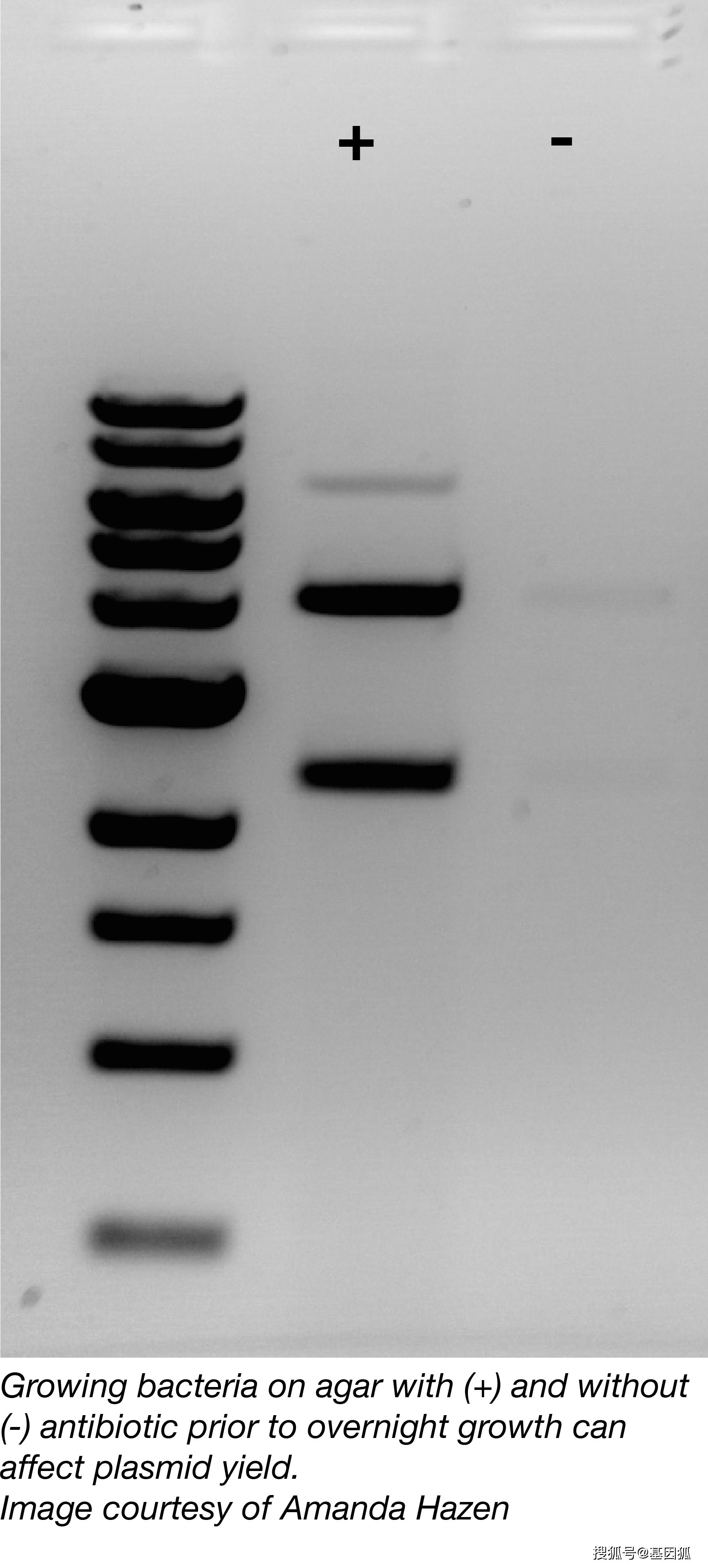 经验分享：如何提高质粒的产量？_培养基_菌种_endA