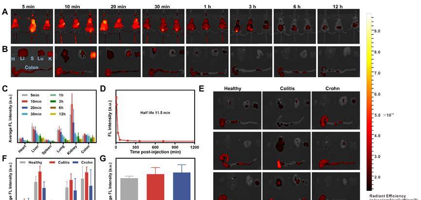 Carbon - 多功能碳点纳米酶兼具荧光成像及SOD性质用于IBD治疗_C-dots_炎症_能力