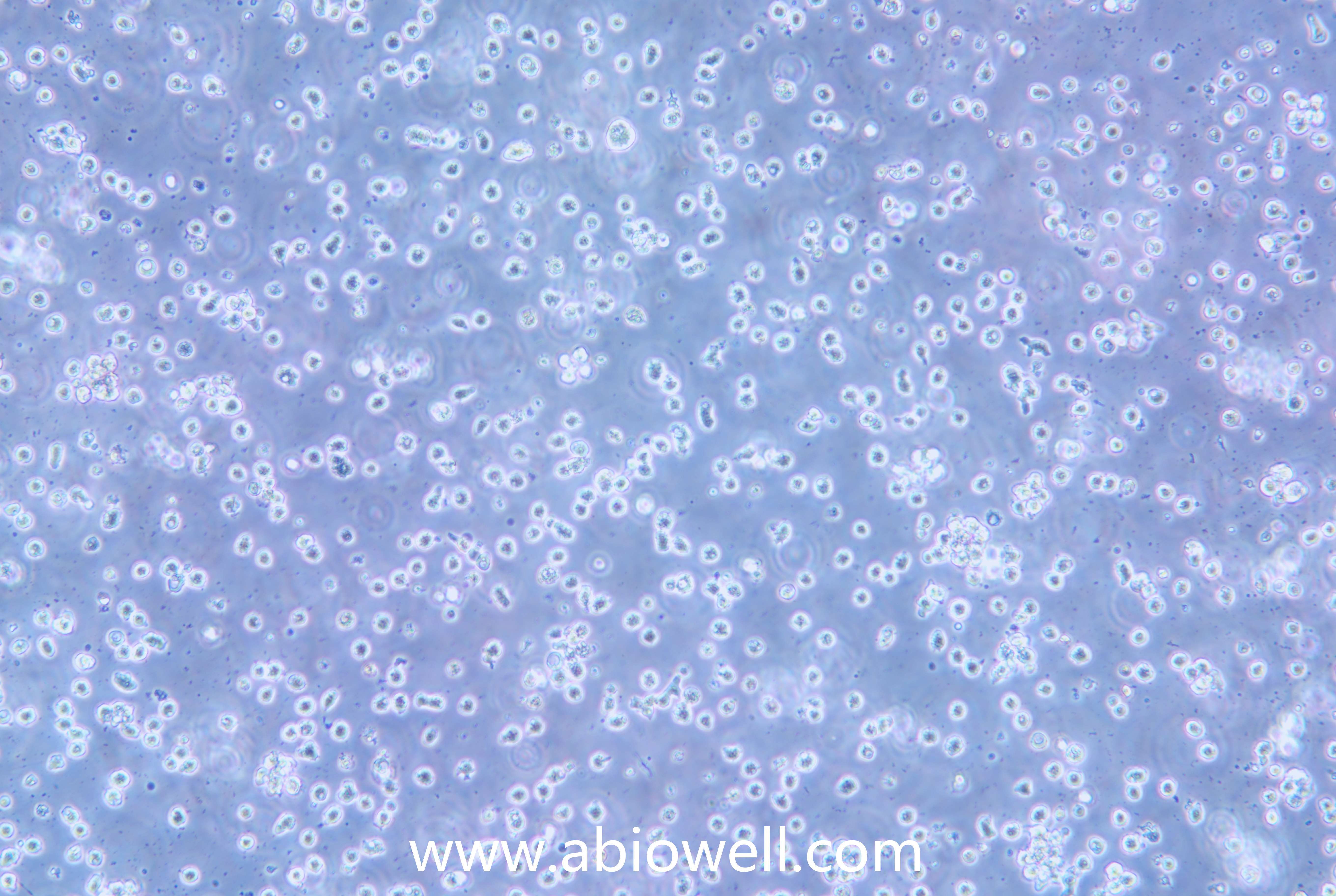 EL-4 (小鼠淋巴瘤细胞)_ml_培养基_处理