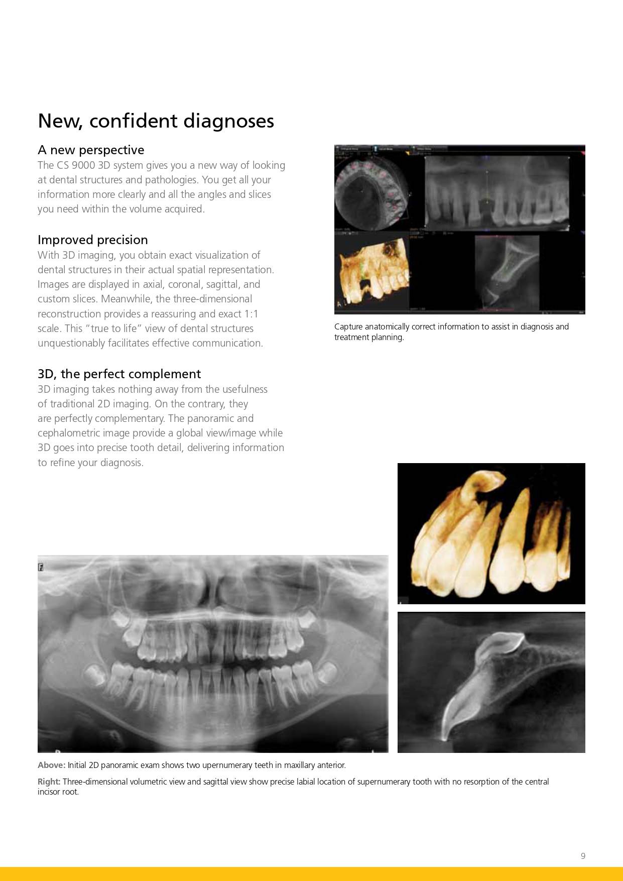 Carestream 9000-搜狐大视野-搜狐新闻