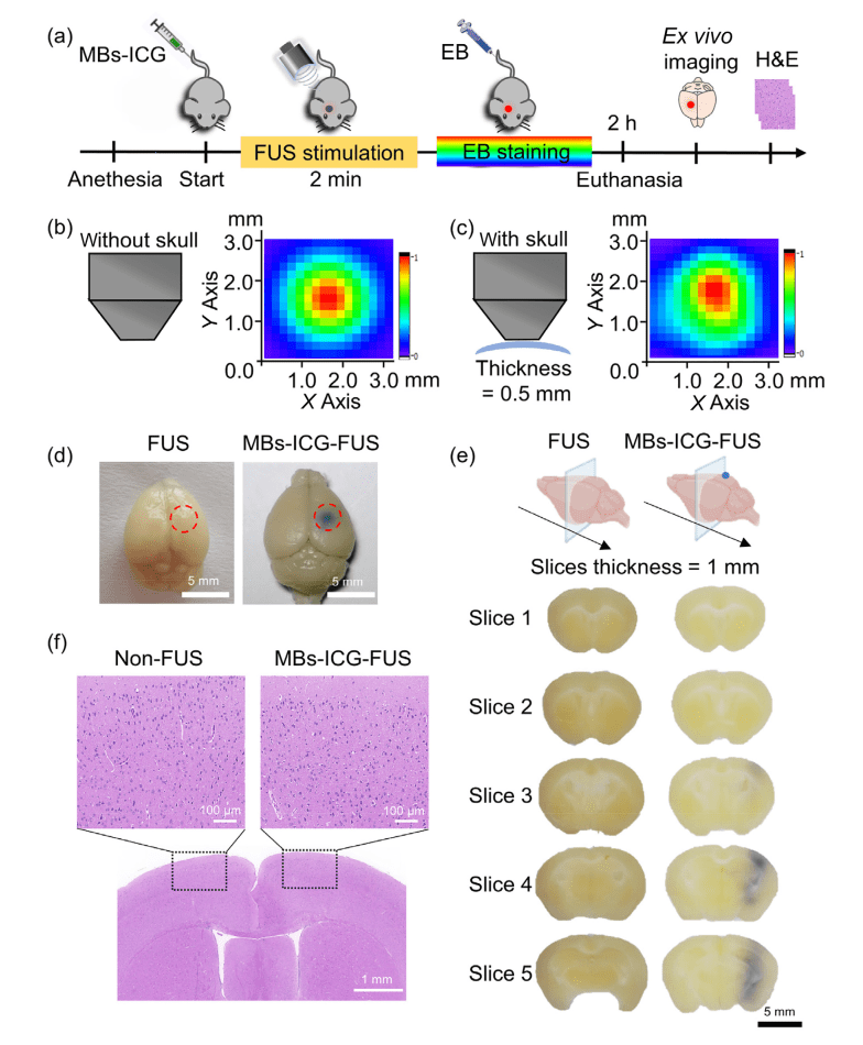 超声诱导血脑屏障开放的NIR-II荧光显像用于ICG微泡增强光热治疗胶质母细胞瘤_成像_方法_监测