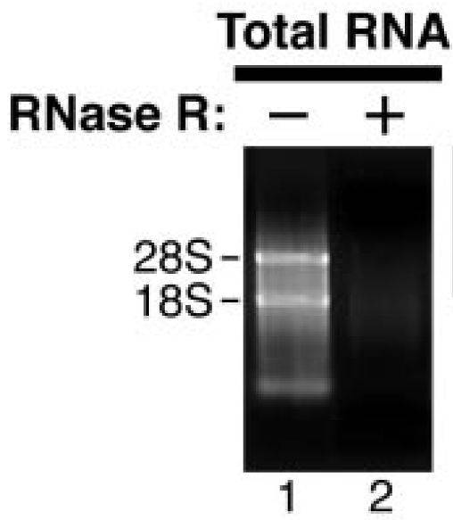干货：RNase R使用攻略_circRNA