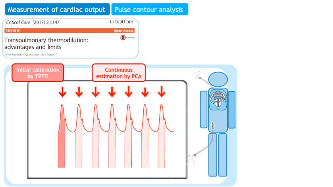 PiCCO在ICU中的应用_进行
