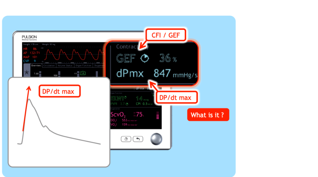 PiCCO在ICU中的应用_进行