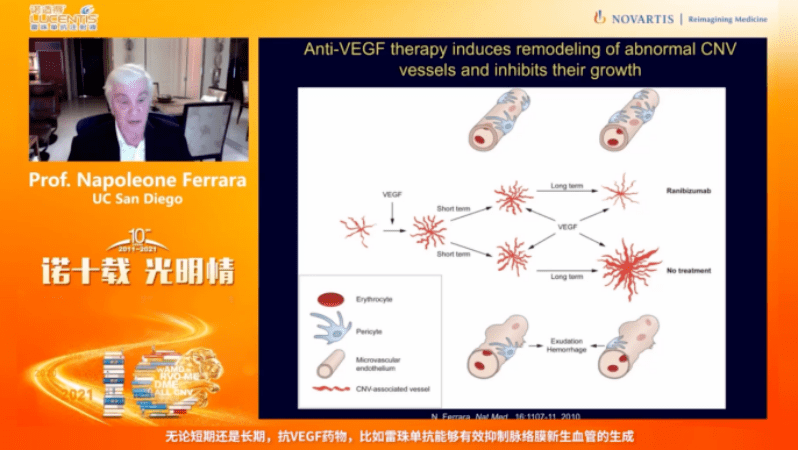 对话抗VEGF之父Napoleone Ferrara丨直击Retina China 2021诺华卫星会_雷珠