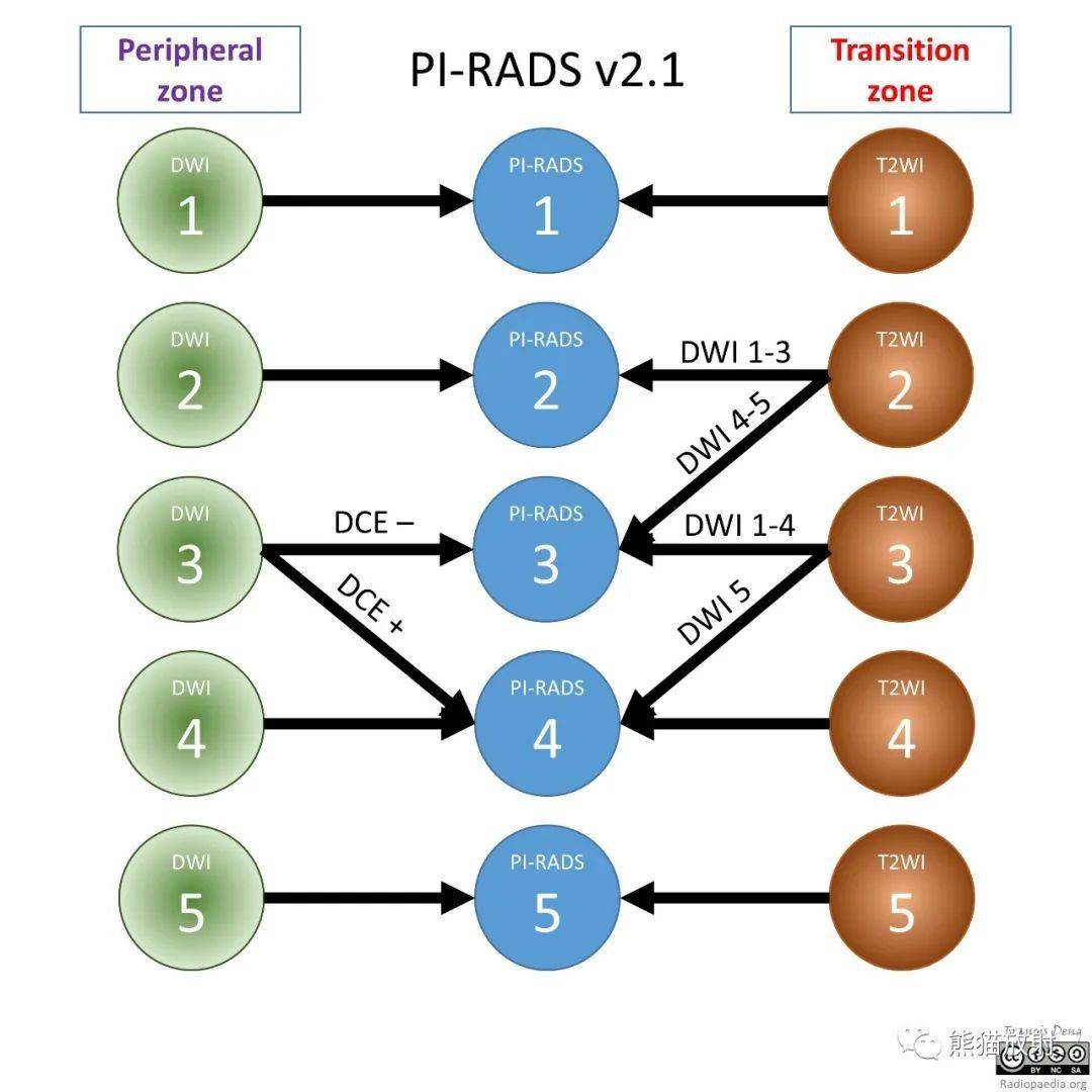 PI-RADS 前列腺影像报告和数据系统_诊断