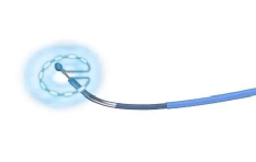 终如愿！波科宣布收购PFA技术执牛耳者Farapulse _导管