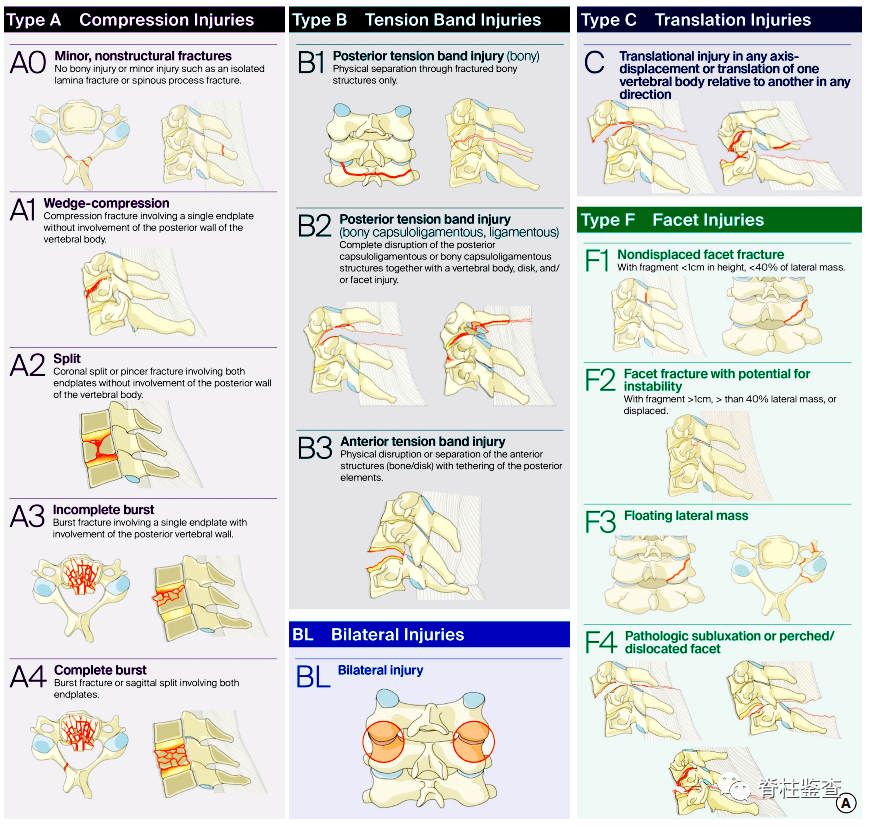 下颈椎损伤：WFNS脊柱委员会指南_关节