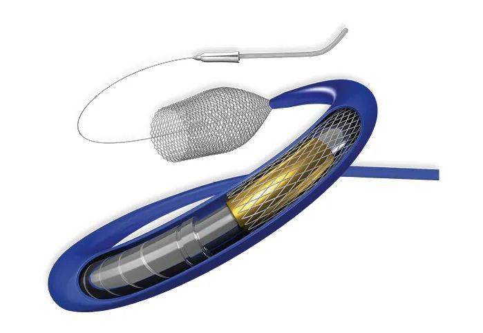 送无阻、顺必达—Phenom™ 27微导管在前循环远端血管中的应用_支架_Flex_血流