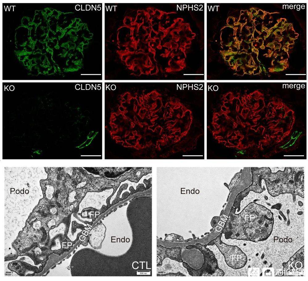 滨州医学院研究团队在国际上首次发现紧密连接跨膜蛋白CLDN5新功能_细胞_疾病_蛋白尿