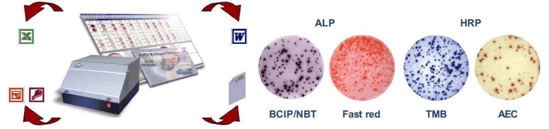 进口酶联免疫斑点分析仪（AID ELISPOT Reader）——泽平科技代理_检测_细胞_进行