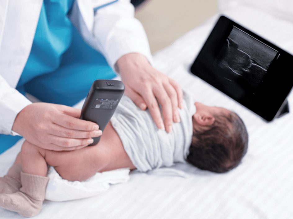 万千视界，无线自由！VINNO P无线掌超开启新传奇_成像_超声_Explore