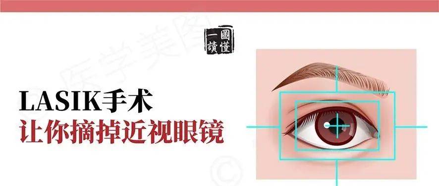简单三步丨LASIK手术让你摘掉近视眼镜_角膜_进行_激光