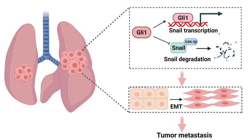 【APSB推荐】调控NSCLC转移调控的新靶点—Gli1_广州医科大学_分子_研究
