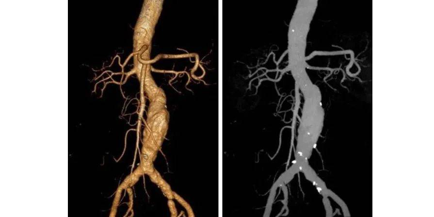 疾病诊断又添“侦察兵”！Optima CT620上线-搜狐大视野-搜狐新闻