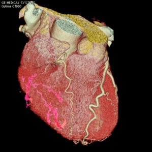 疾病诊断又添“侦察兵”！Optima CT620上线-搜狐大视野-搜狐新闻