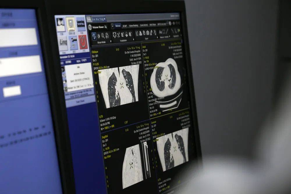 疾病诊断又添“侦察兵”！Optima CT620上线-搜狐大视野-搜狐新闻