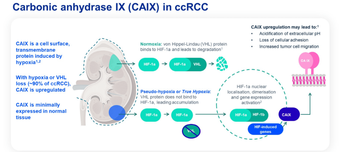 ASCO-GU 2023丨ADC的全新打开方式：CAIX分子显像技术可用于肾癌精准诊断_研究_ccRCC_肿瘤