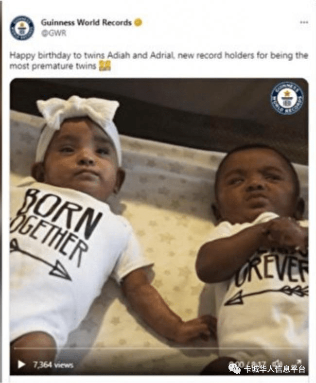 加拿大双胞胎一岁生日时 创下吉尼斯世界纪录_Adrial_Adiah_弟弟