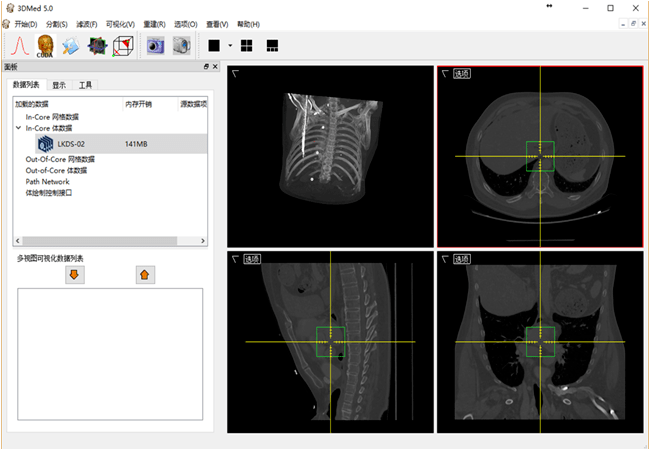 【研发】中国科学院分子影像重点实验室集成化医学影像算法平台及系列软件系统_DMed_处理_分析
